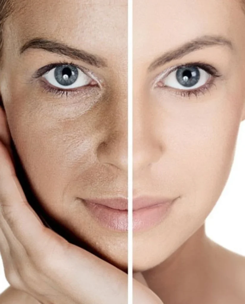 Pigmentation Treatment in Islamabad | Skin Pigmentation Solutions